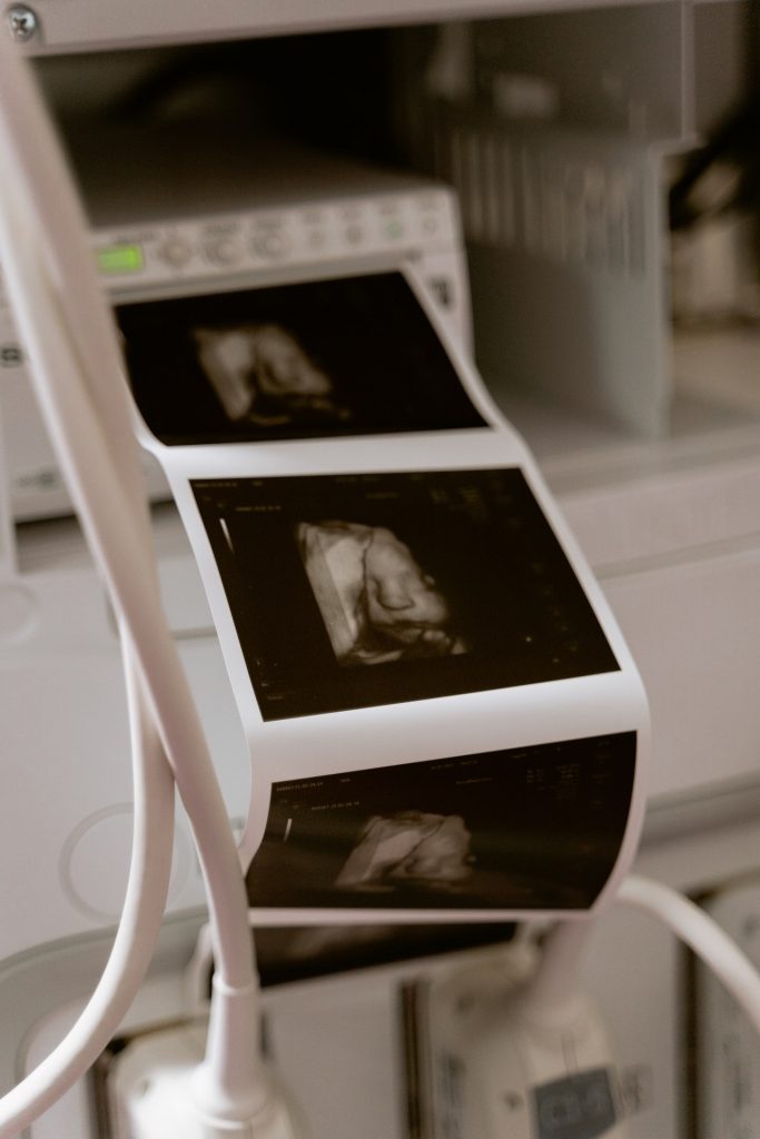 wmgultrasounds.com – Elective Entertainment- only prenatal ultrasounds